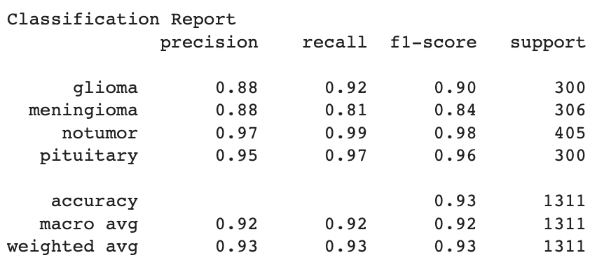 GitHub - ayyucedemirbas/brain_tumor_classification