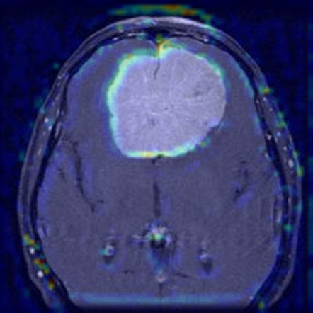 GitHub - ayyucedemirbas/brain_tumor_classification