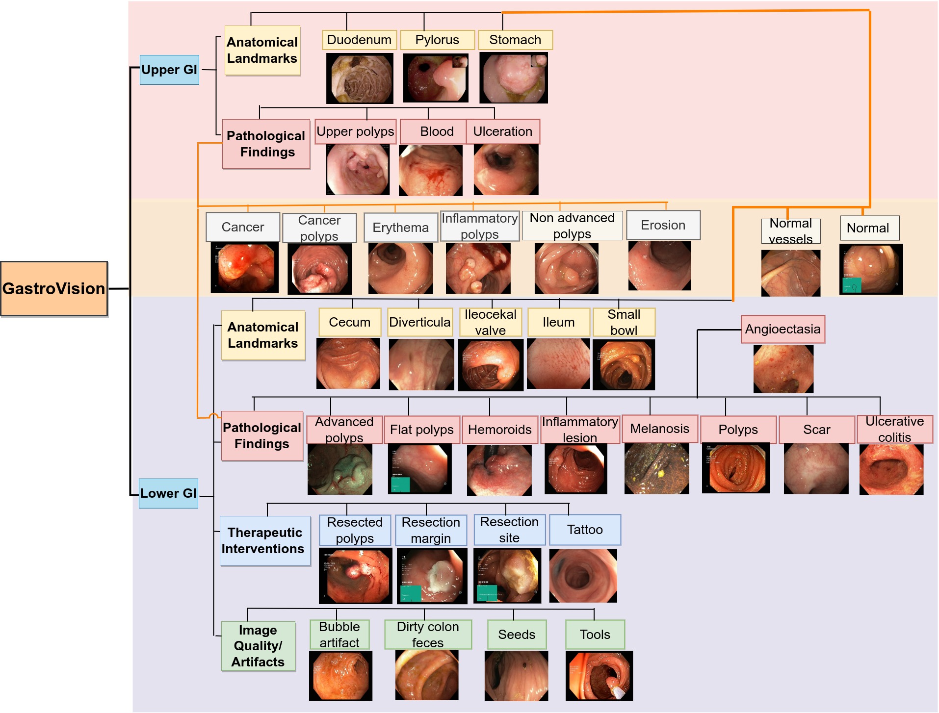 GitHub - DebeshJha/GastroVision: GastroVision: A Multi-class Endoscopy ... GitHub - DebeshJha/GastroVision: GastroVision: A Multi-class Endoscopy ...