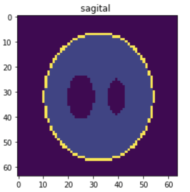 GitHub - baglanaitu/Shepp-Logan-phantom-and-3D-surface-extraction: The goal of this assignment ...