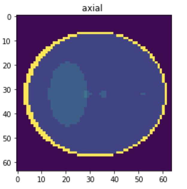 GitHub - baglanaitu/Shepp-Logan-phantom-and-3D-surface-extraction: The ...