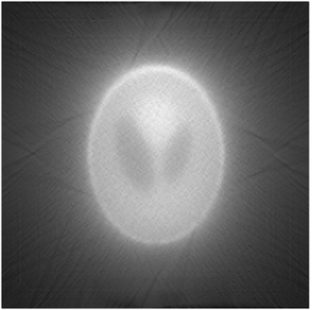 Tomographic-reconstruction-in-2D-by-sinograms/README.md at main · baglanaitu/Tomographic ...