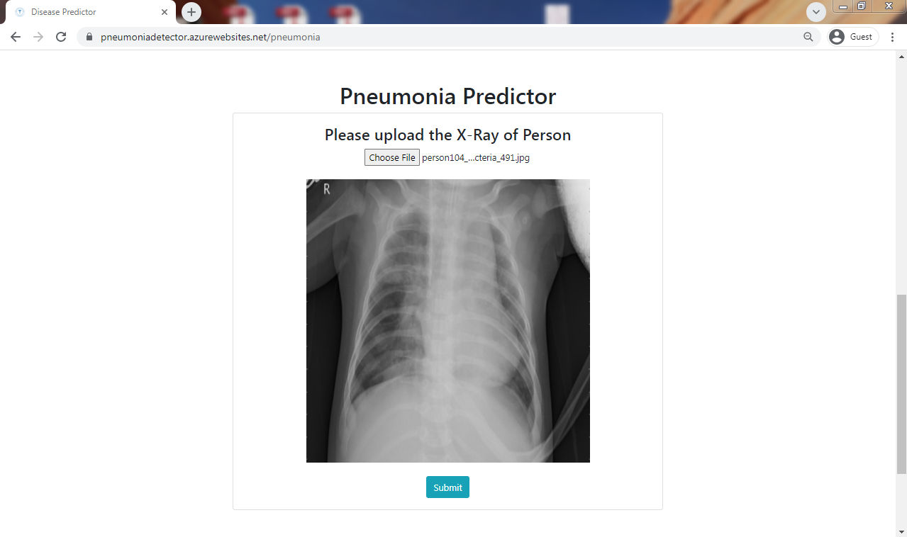 GitHub - KuberAnand/pneumonia-detector-final: Pneumonia Predictor - Detects sample whether ...