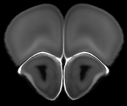 DeepSlice web gives much better results than the offline version · Issue #43 · PolarBean ...