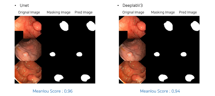 GitHub - Lee-jun-young98/Detection_Polyps_using_Deep_Learning