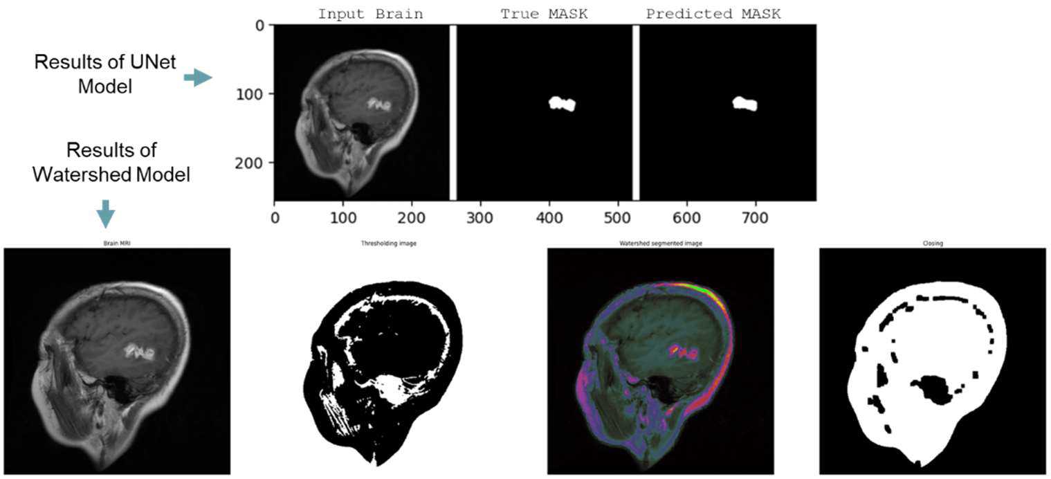 Github Engineer Ayesha Shafique Brain Tumor Segmentation And