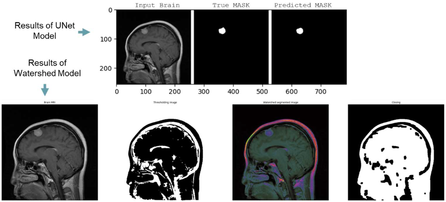 Github Engineer Ayesha Shafique Brain Tumor Segmentation And Detection Using Unet And