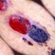 GitHub - yasmine01545/Skin-cancer-Diseases-Classification-using ...