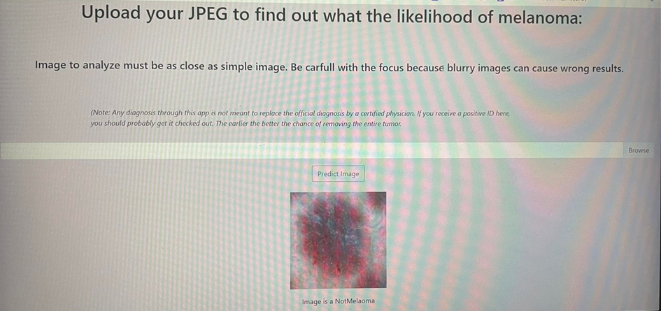 photo · Issue #5 · yasmine01545/Skin-cancer-Diseases-Classification-using-Transfer-Learning-and ...