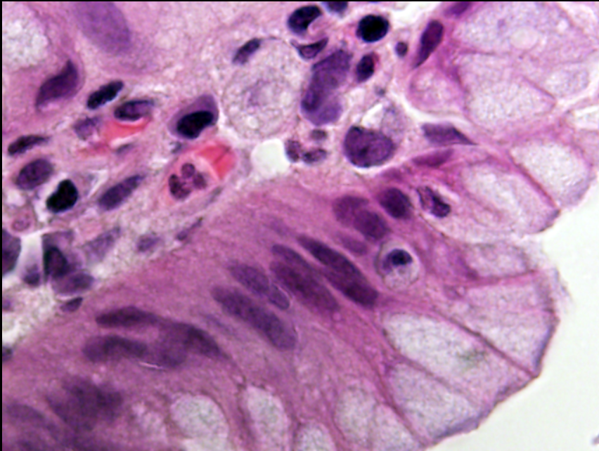 GitHub - Siddhant128-bit/Unet_vs_Ghosted_Unet: This repo is for research purpose where we shall ...