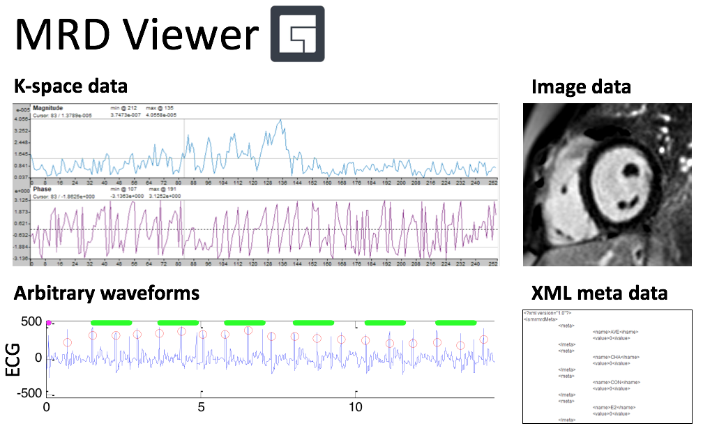 ISMRM Raw Data Viewer · Issue #4 · mrathon/idea-pitches · GitHub