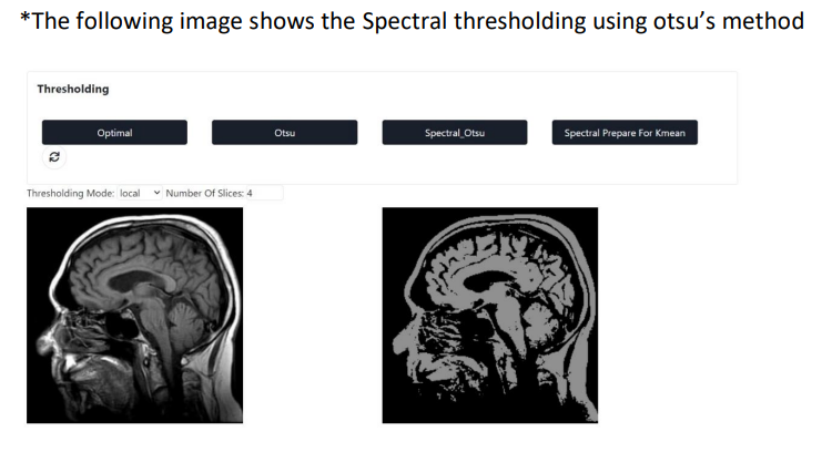 GitHub - ezzat223/Computer-Vision_Image-Segmentation-and-Thresholding.: Image Segmentation and ...