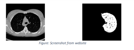 GitHub - ezzat223/Computer-Vision_Image-Segmentation-and-Thresholding ...