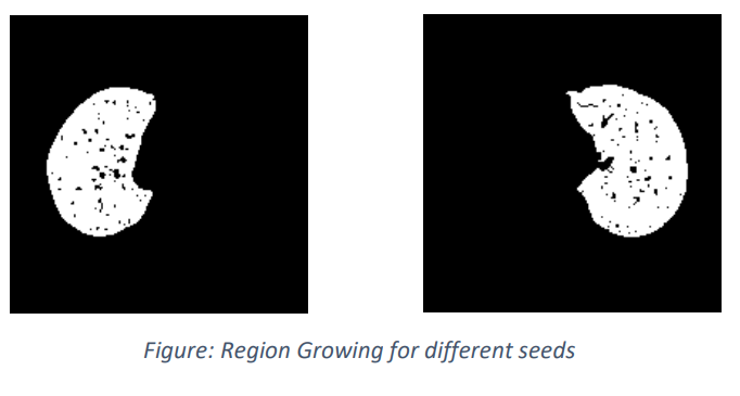 GitHub - ezzat223/Computer-Vision_Image-Segmentation-and-Thresholding ...