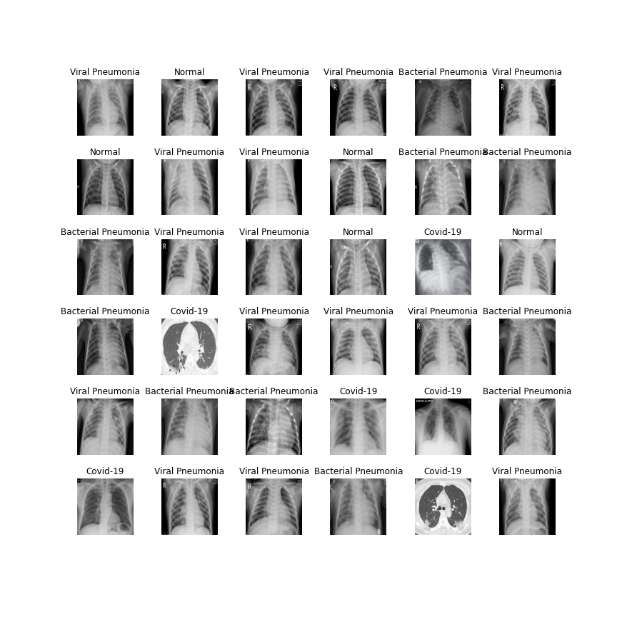GitHub - ShojibDE/Project-4-Medical-Images: Classify chest disease to ...
