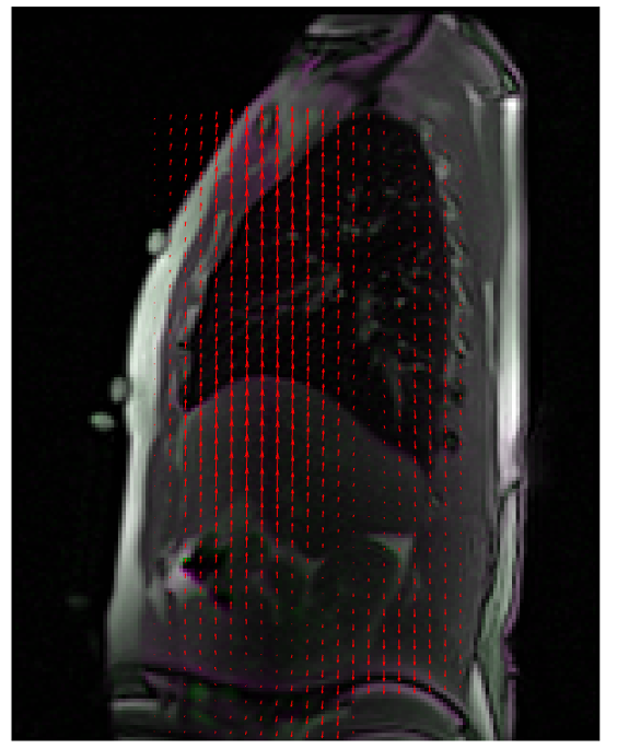 Displacement field acquisition issue · Issue #1425 · SimpleITK/SimpleITK · GitHub