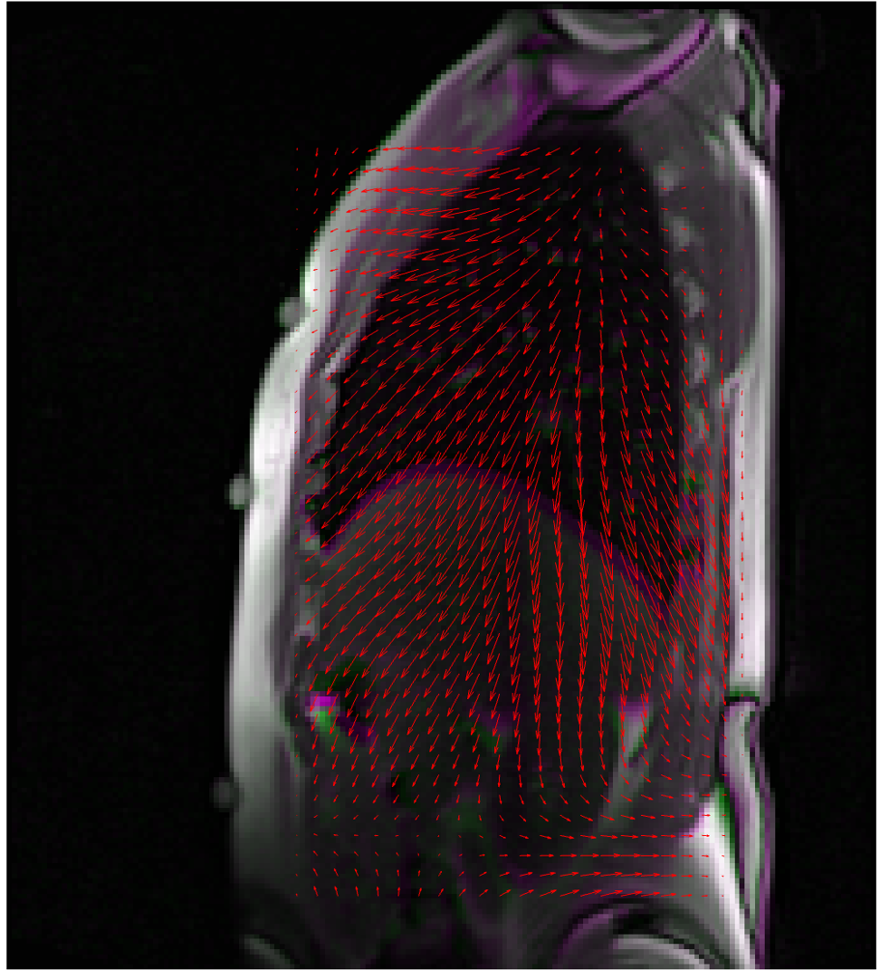 Displacement field acquisition issue · Issue #1425 · SimpleITK/SimpleITK · GitHub