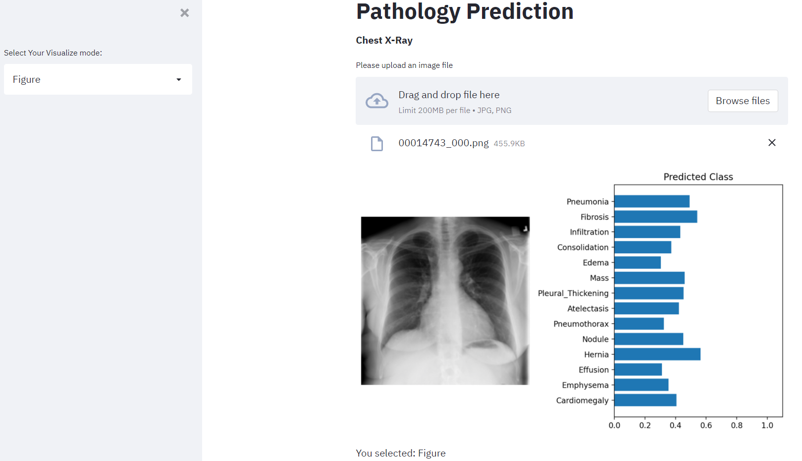 GitHub - miladlink/MultiLabel_ChestX-Ray_Streamlit