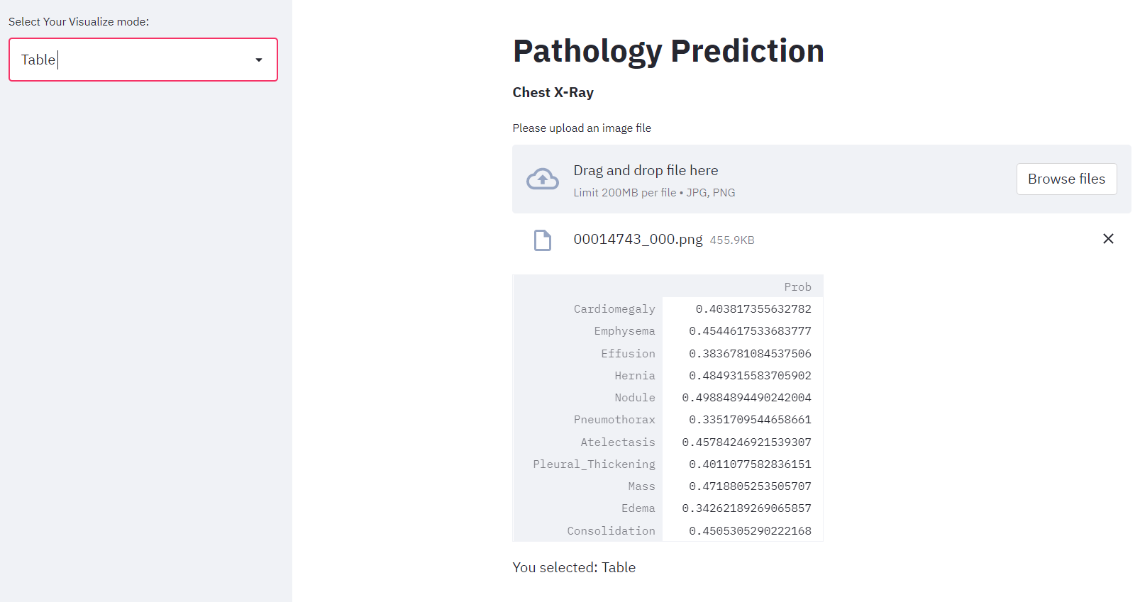 GitHub - miladlink/MultiLabel_ChestX-Ray_Streamlit