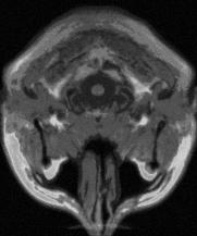 GitHub - sraycju/BrainTumorSegmentation: Brain Tumor Segmentation using CNN