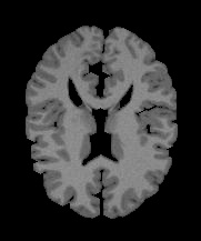 GitHub - sraycju/BrainTumorSegmentation: Brain Tumor Segmentation using CNN