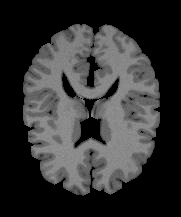 GitHub - sraycju/BrainTumorSegmentation: Brain Tumor Segmentation using CNN