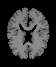 GitHub - sraycju/BrainTumorSegmentation: Brain Tumor Segmentation using CNN