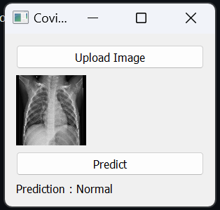 GitHub - iamumarjaved/Covid-19-Detection-using-X-rays-with-ML: It detects the X-Rays and can ...