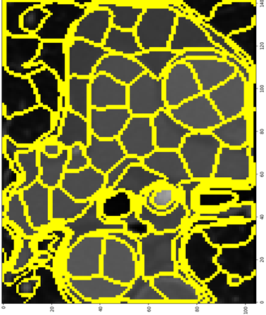 GitHub - SpyridoulaZagkou4/ct_superpixel_segmentation