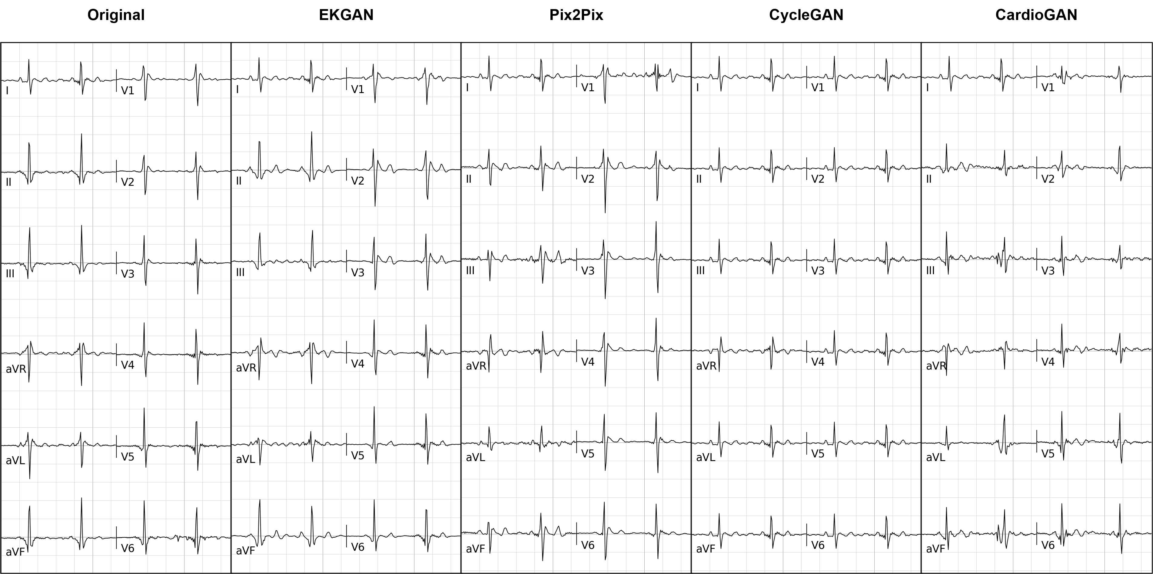 Github Joojinho97 Ecg Reconstruction Ecg Reconstruction For Detect Multi Label Diseases