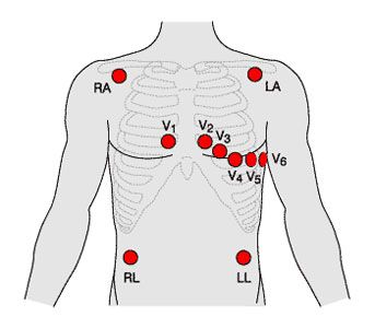 GitHub - joojinho97/ecg_reconstruction: ecg_reconstruction for detect ...
