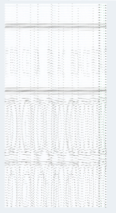 cv.Vec color and getRegion problems · Issue #402 · justadudewhohacks/opencv4nodejs · GitHub