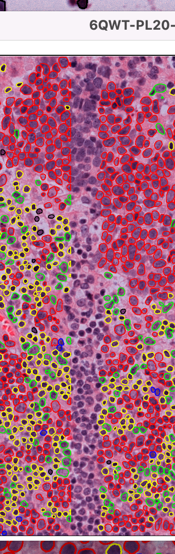 Vertical strips of regions left out on cell segmentation/inference · Issue #482 ...
