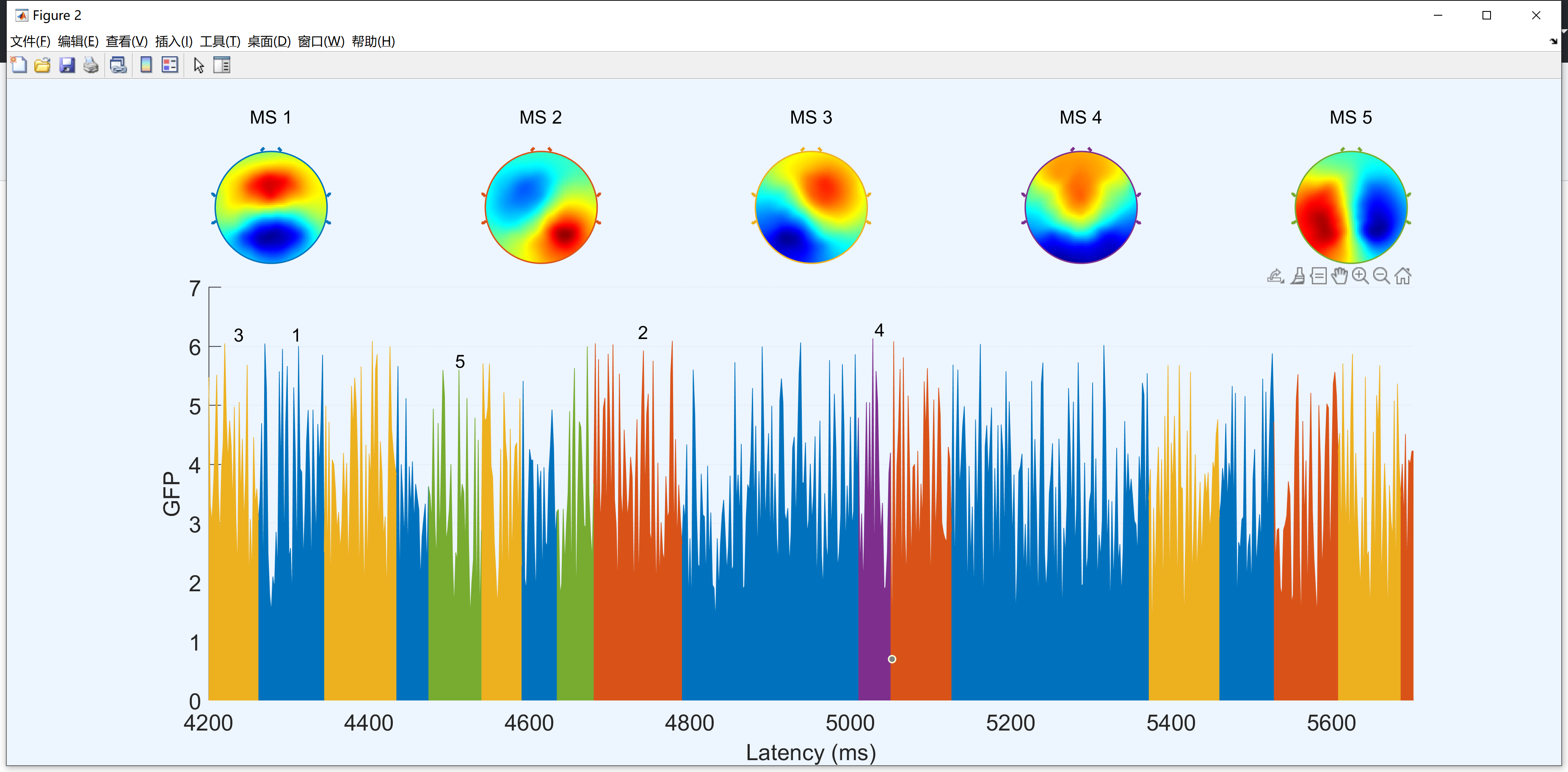 Temporally smooth microstate labels · Issue #7 · atpoulsen/Microstate-EEGlab-toolbox · GitHub