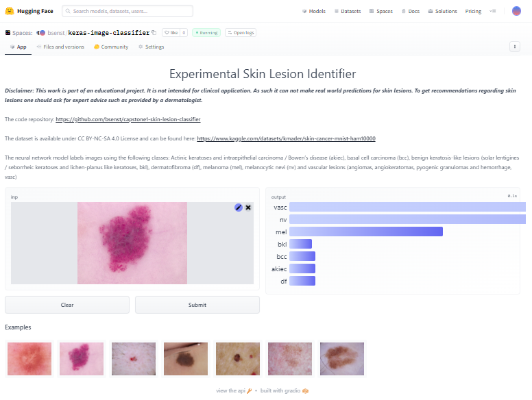 GitHub - bsenst/capstone1-skin-lesion-classifier: Experimental neural network to classify skin ...