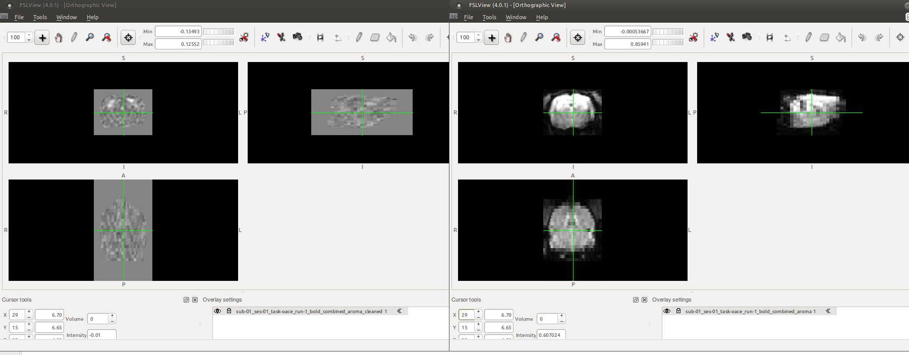 TR listed is incorrect when loading files in FSL · Issue #151 · CoBrALab/RABIES · GitHub
