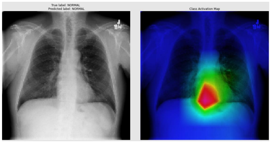 GitHub - HC0416/COVID-19-Pneumonia-Detection-Web-Based-Managent-System
