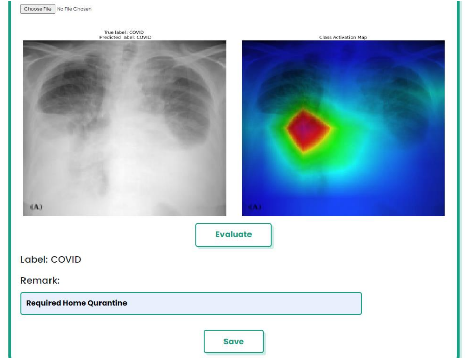 GitHub - HC0416/COVID-19-Pneumonia-Detection-Web-Based-Managent-System