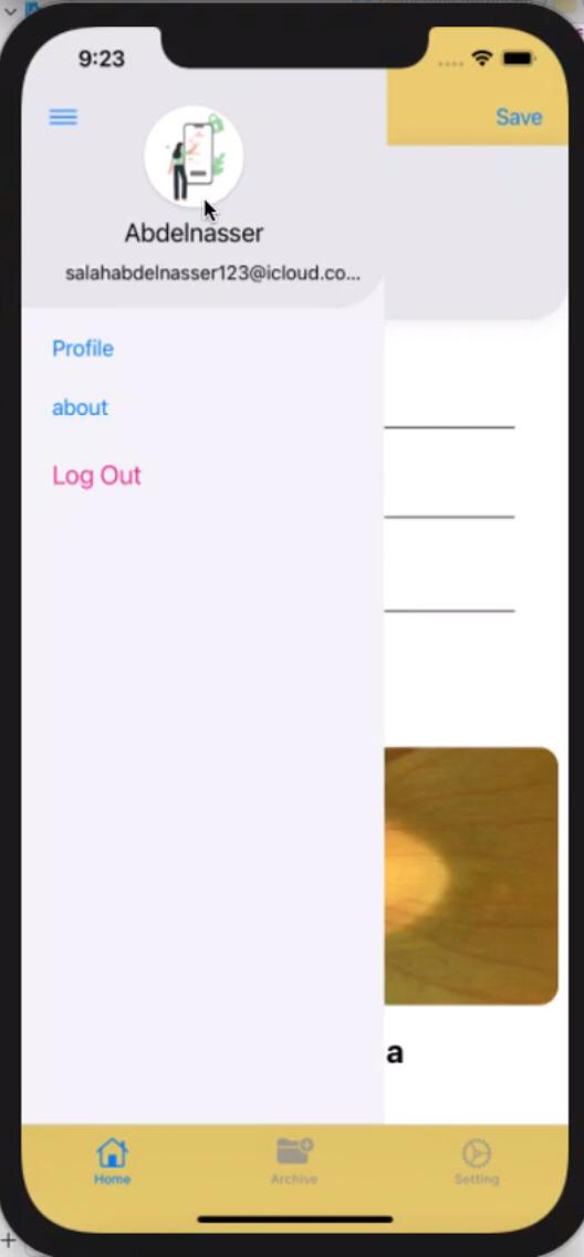 GitHub - Abdelnasser100/Glaucoma-detection