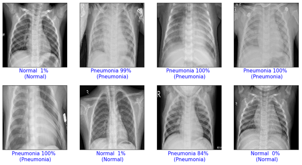 GitHub - bhushany96/Medical-Images-Classification