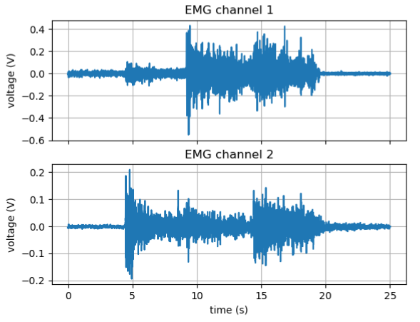 GitHub - Rionzagal/EMG_RNN