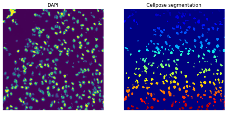 Default color of segmentation masks · Issue #522 · scverse/squidpy · GitHub