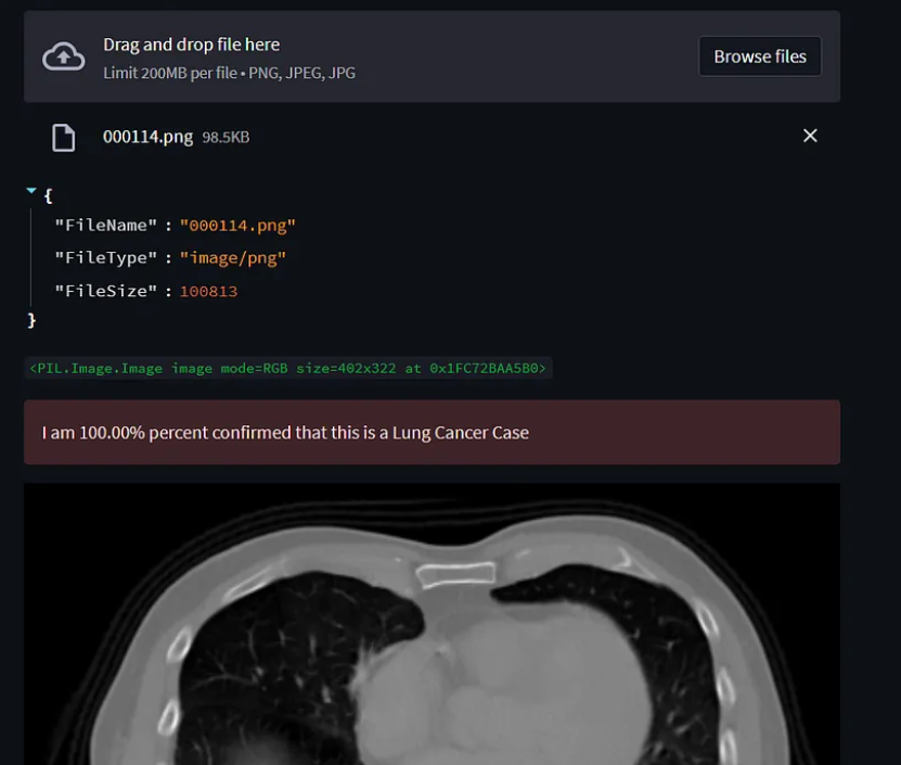 GitHub - vedantkadam/Lung_Cancer_CNN: Lung Cancer Detection using ...