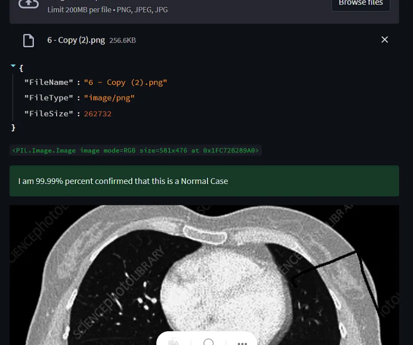 GitHub - vedantkadam/Lung_Cancer_CNN: Lung Cancer Detection using Machine Learning