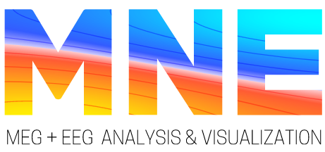 GitHub - kosonkh7/Software-Convergence-Capstone-Design: EEG 데이터를 이용한 사회적, 비사회적 공동관심이 작업 기억에 미치는 ...