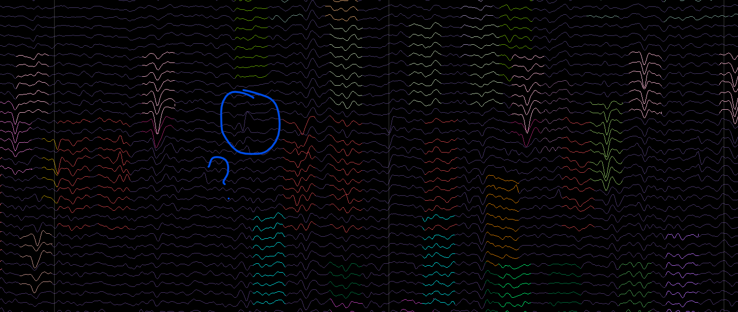 Complex spikes · Issue #536 · MouseLand/Kilosort · GitHub