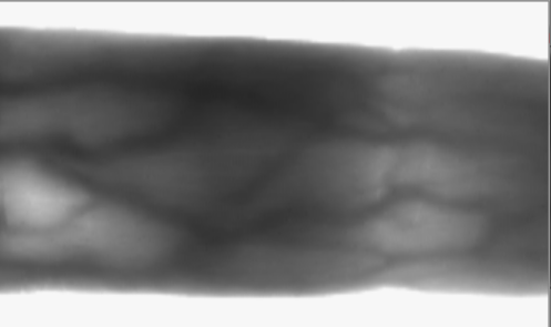 GitHub - takiee/finger-vein-recognition: Research and Implementation of Finger Vein Recognition ...