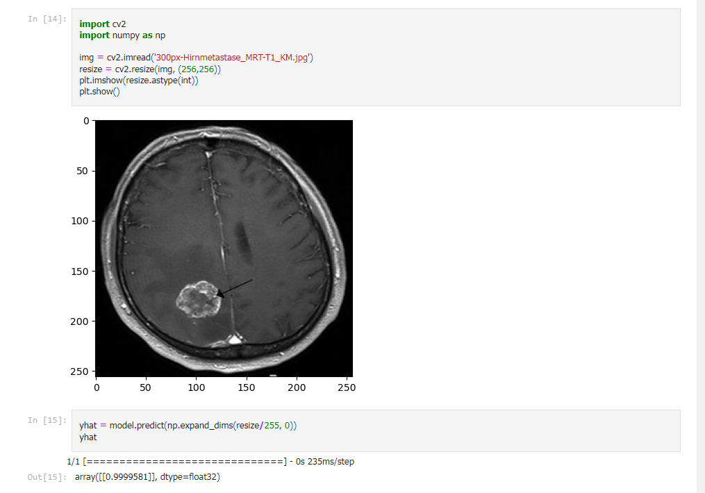 GitHub - SupeemAFK/Brain-Tumor-MRI-Classification
