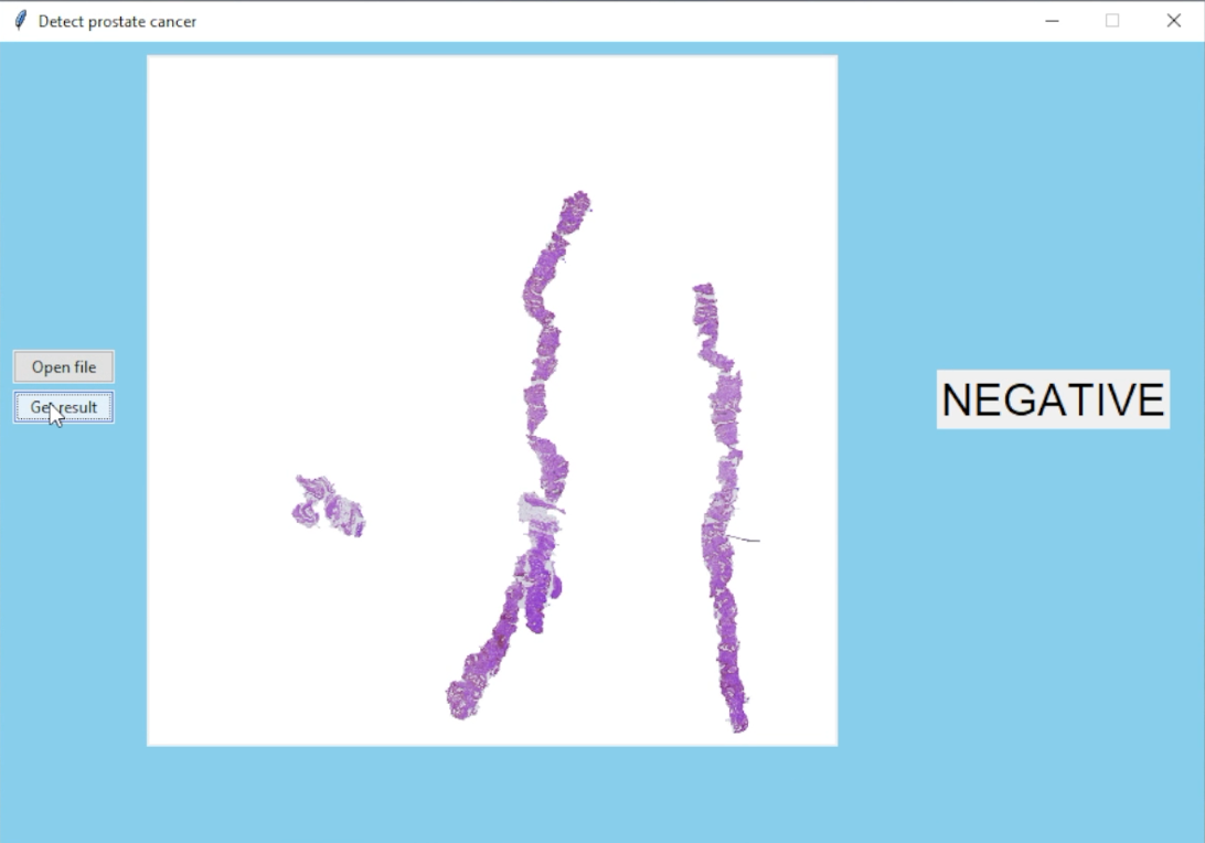 GitHub - anapapara/BiopsyClassification: Application with graphic user interface for prostate ...