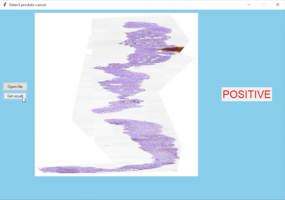 GitHub - anapapara/BiopsyClassification: Application with graphic user interface for prostate ...